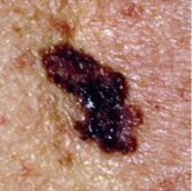 Álvaro Leiva Dermatólogo